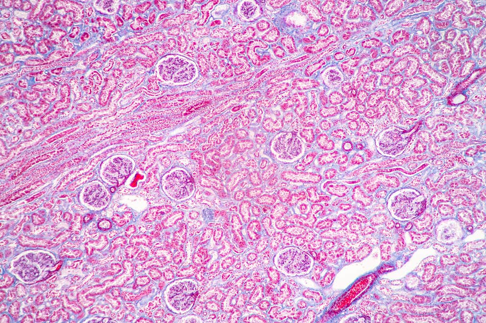 Tissue of Spleen Human, Liver Human and Kidney Human Under the ...