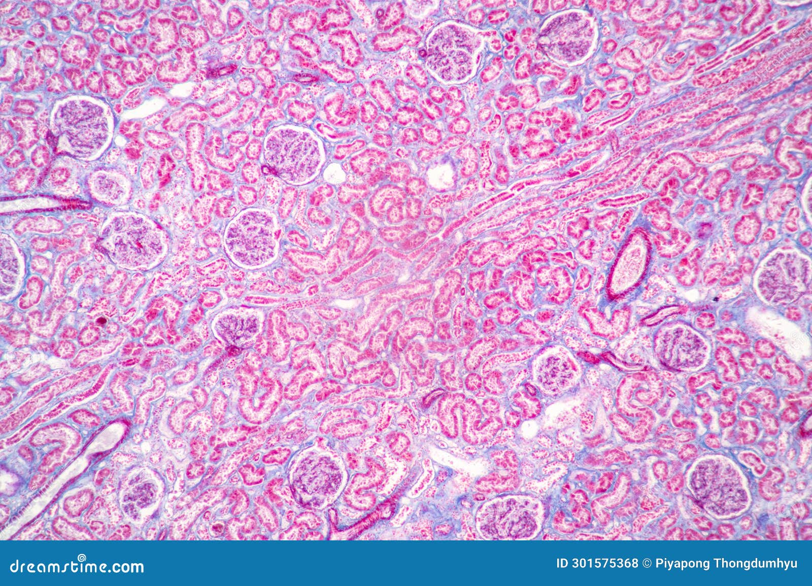 Tissue Of Spleen Human, Liver Human And Kidney Human Under The ...
