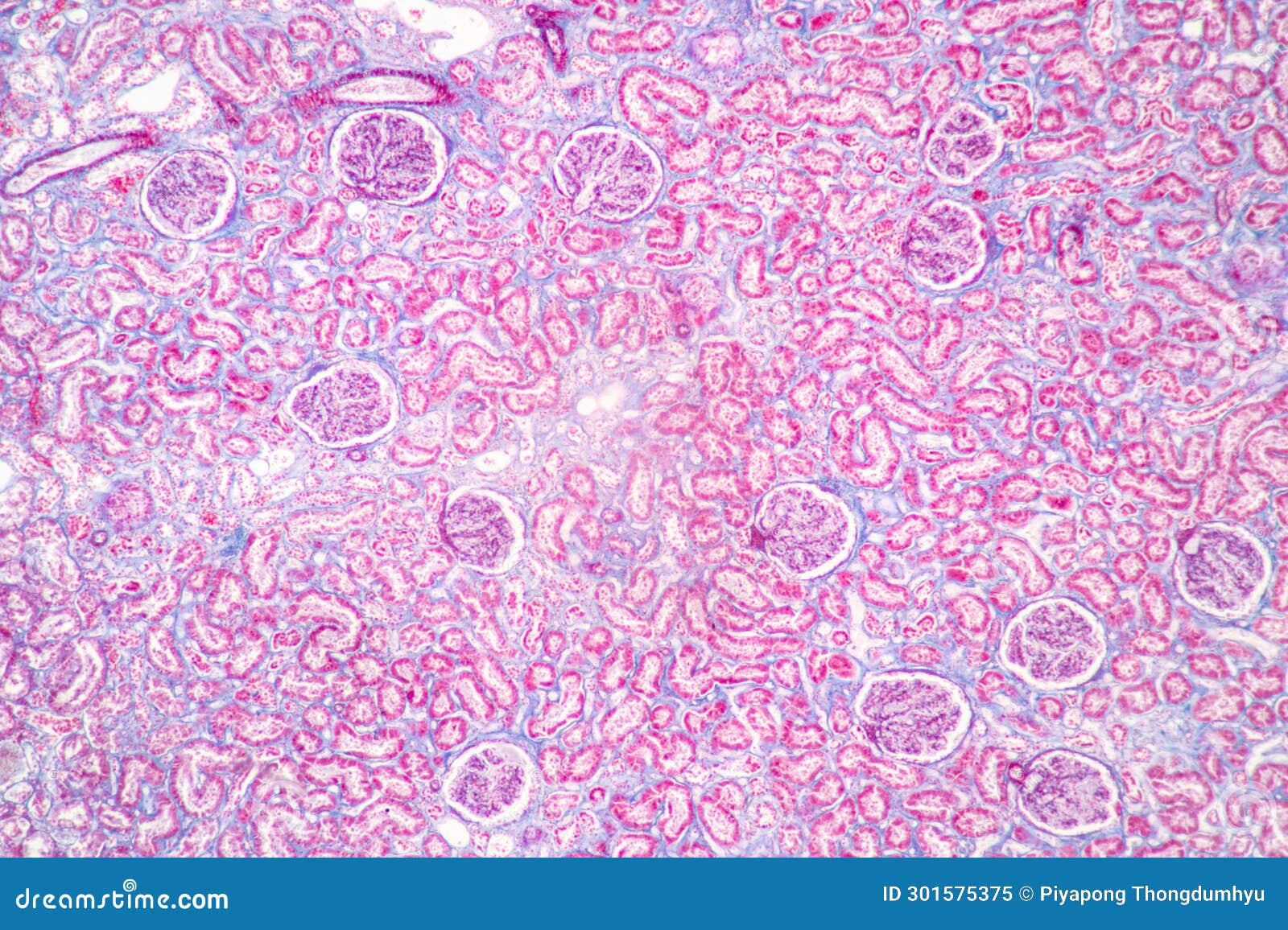 Tissue of Spleen Human, Liver Human and Kidney Human Under the ...