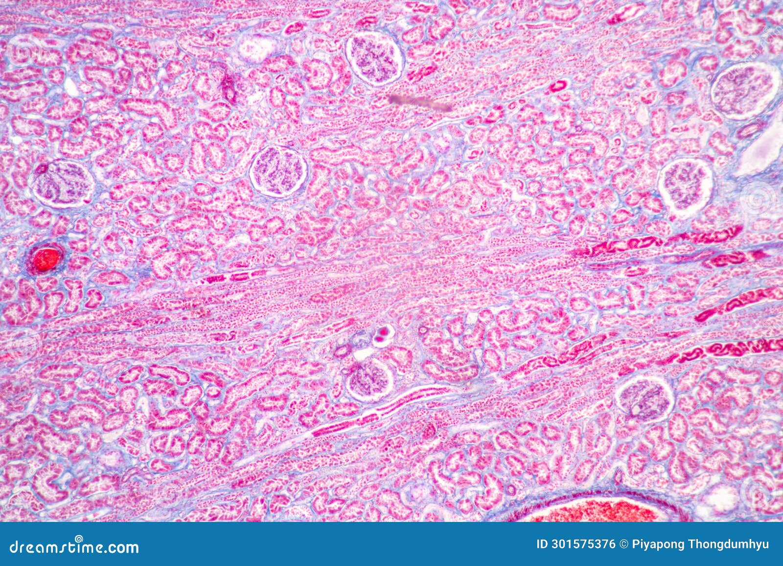 Tissue of Spleen Human, Liver Human and Kidney Human Under the ...