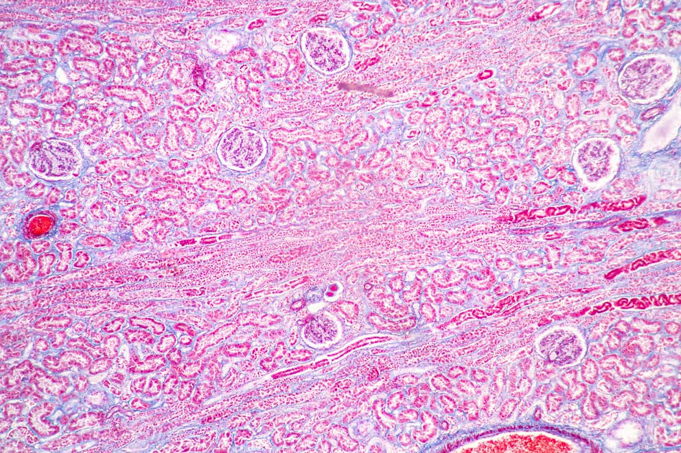 Tissue of Spleen Human, Liver Human and Kidney Human Under the ...