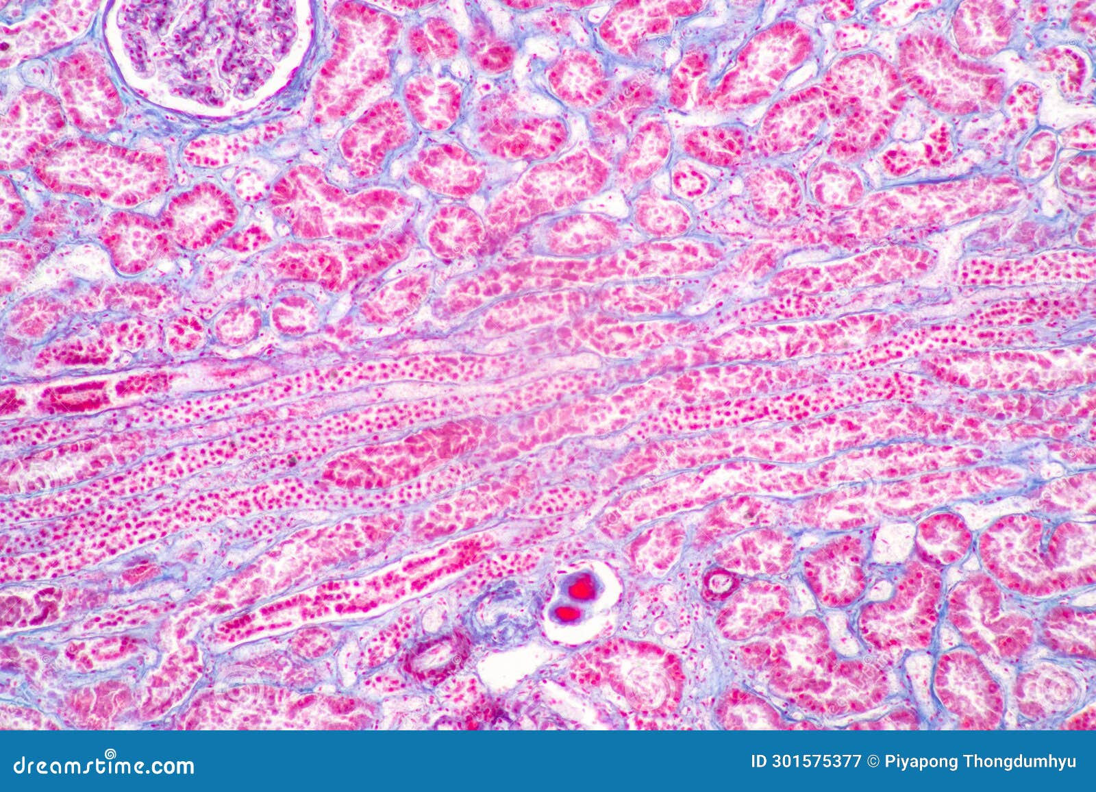 Tissue of Spleen Human, Liver Human and Kidney Human Under the ...