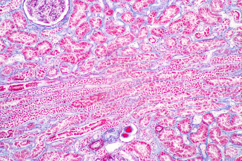 Tissue of Spleen Human, Liver Human and Kidney Human Under the ...