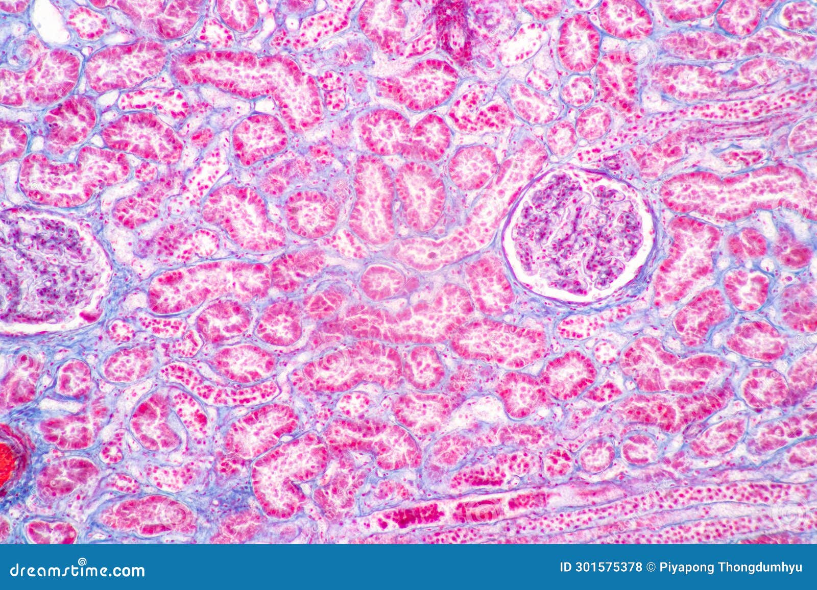 Tissue Of Spleen Human, Liver Human And Kidney Human Under The ...