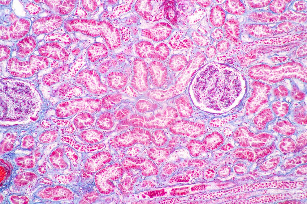 Tissue of Spleen Human, Liver Human and Kidney Human Under the ...