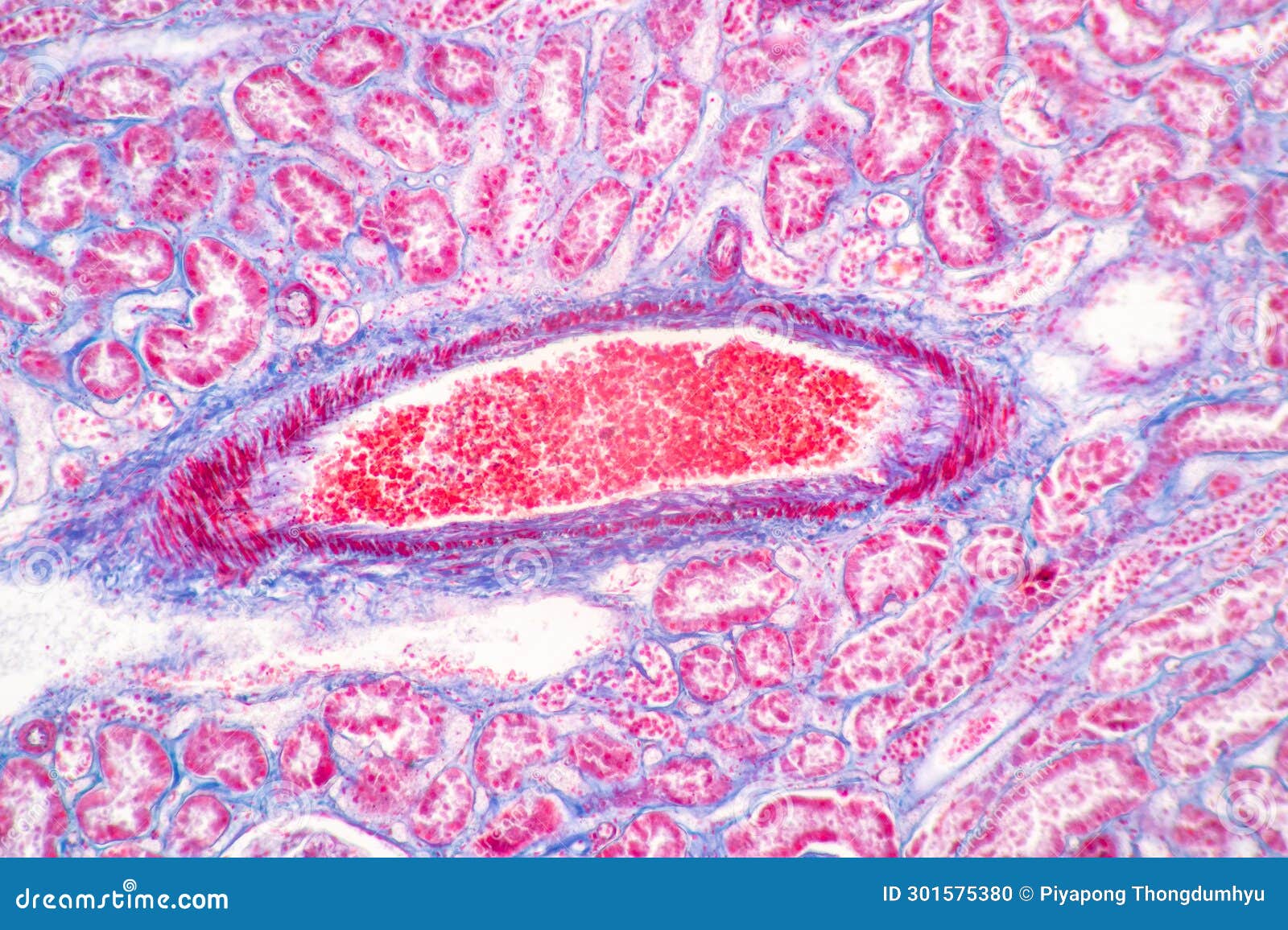 Tissue of Spleen Human, Liver Human and Kidney Human Under the ...