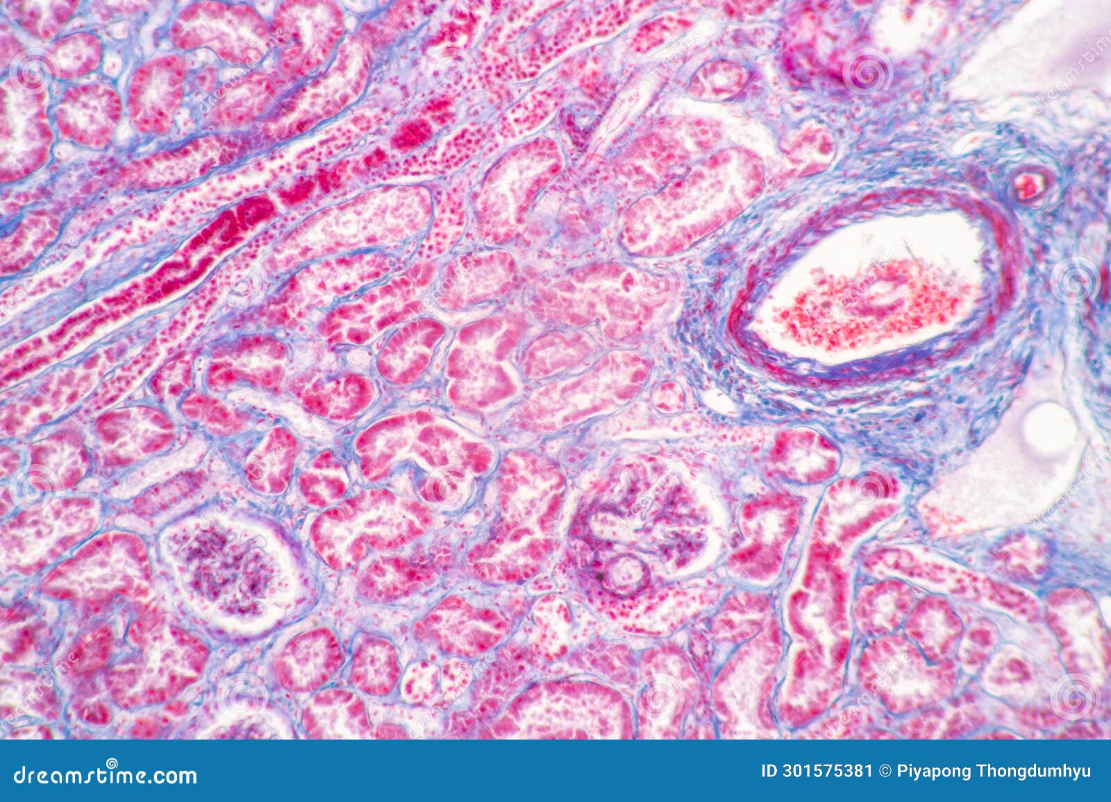 Tissue of Spleen Human, Liver Human and Kidney Human Under the ...