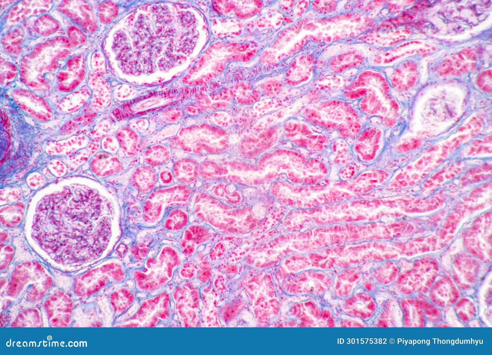 Tissue of Spleen Human, Liver Human and Kidney Human Under the ...