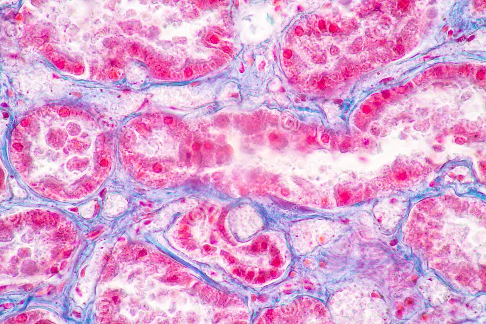 Tissue of Spleen Human, Liver Human and Kidney Human Under the ...