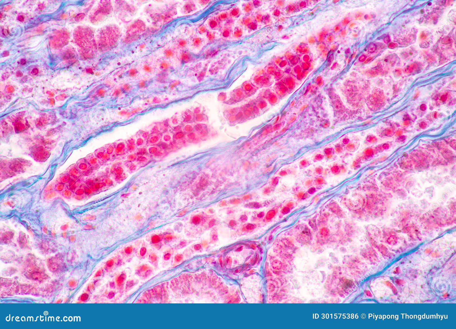 Tissue of Spleen Human, Liver Human and Kidney Human Under the ...