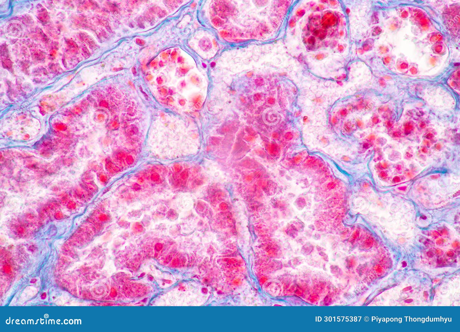 Tissue of Spleen Human, Liver Human and Kidney Human Under the ...
