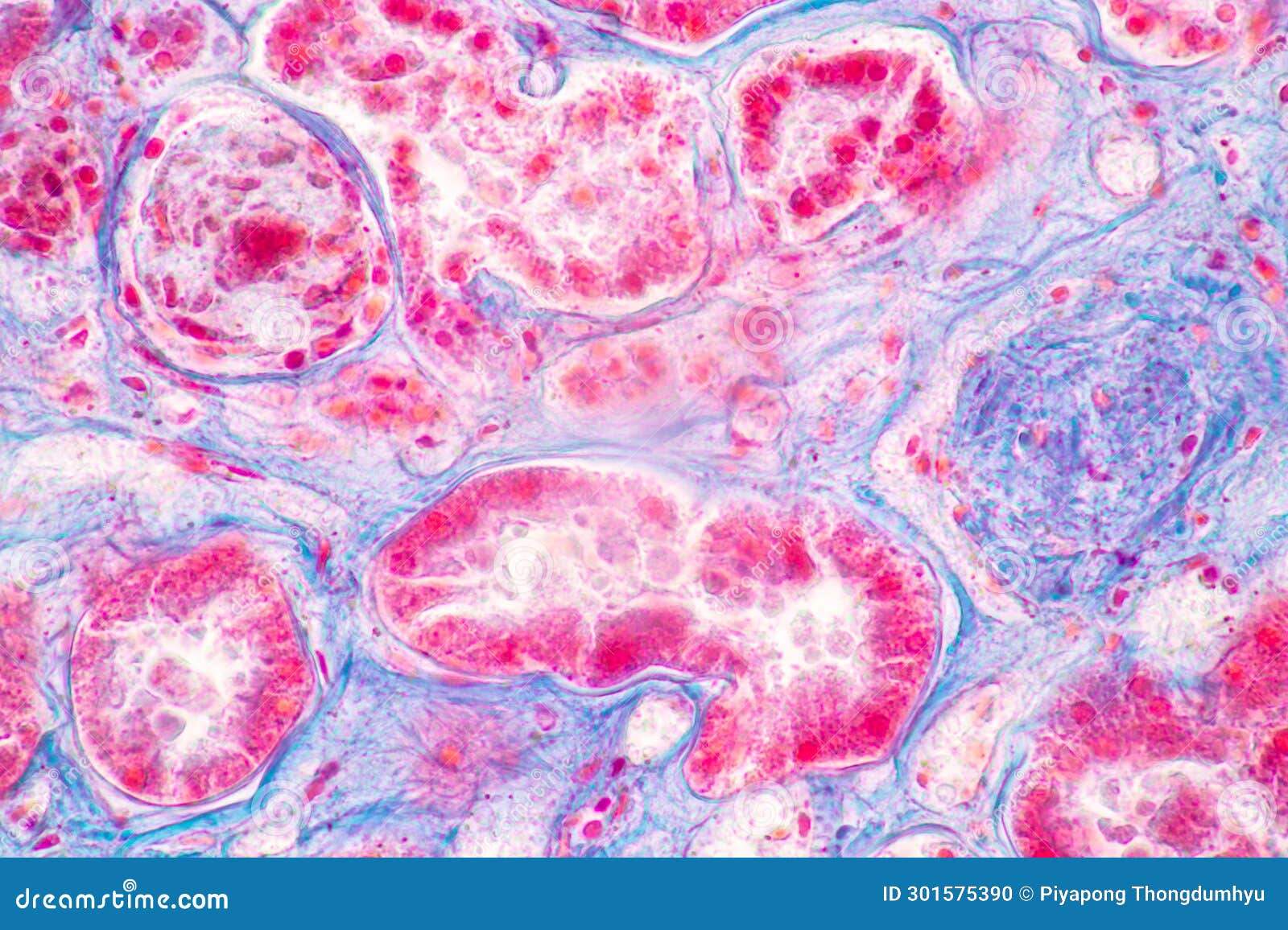 Tissue of Spleen Human, Liver Human and Kidney Human Under the ...