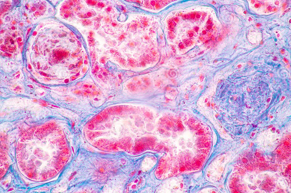 Tissue of Spleen Human, Liver Human and Kidney Human Under the ...