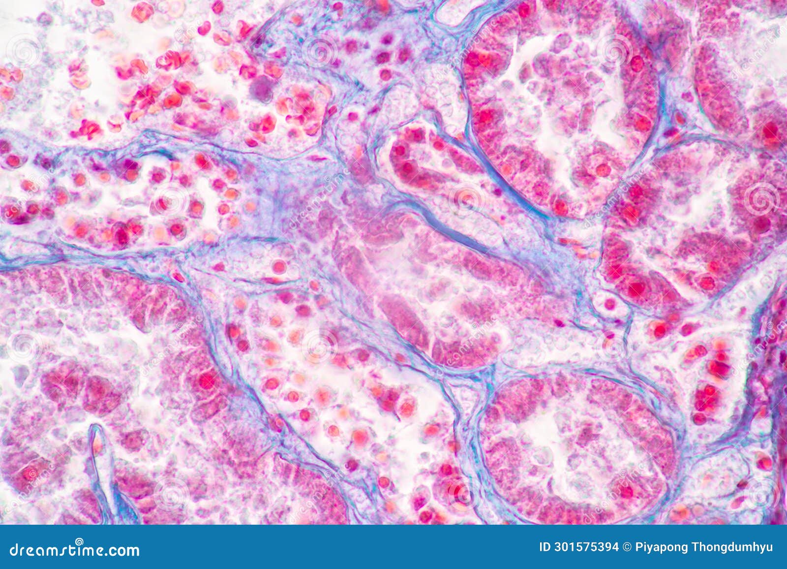 Tissue of Spleen Human, Liver Human and Kidney Human Under the ...
