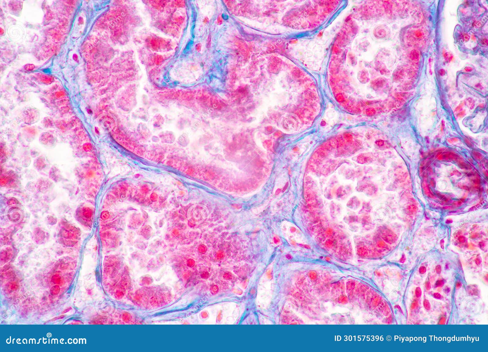 Tissue of Spleen Human, Liver Human and Kidney Human Under the ...