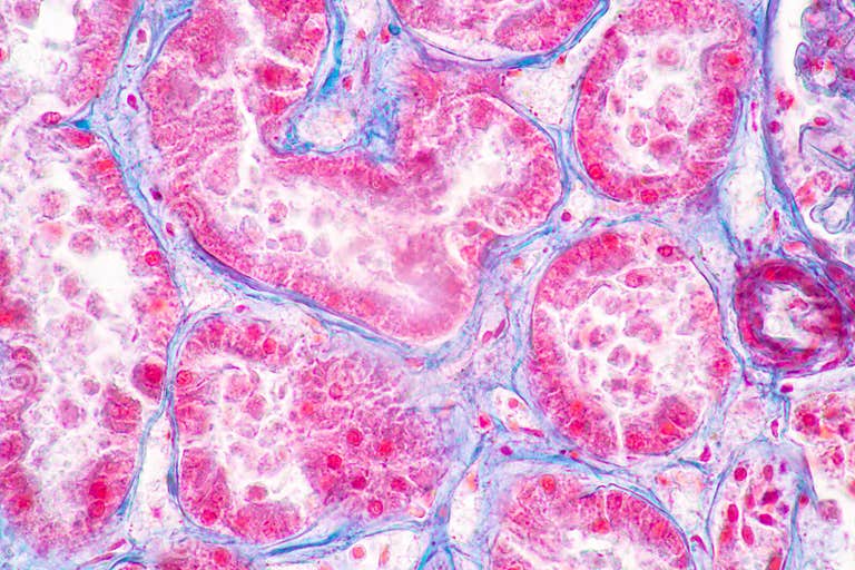 Tissue of Spleen Human, Liver Human and Kidney Human Under the ...