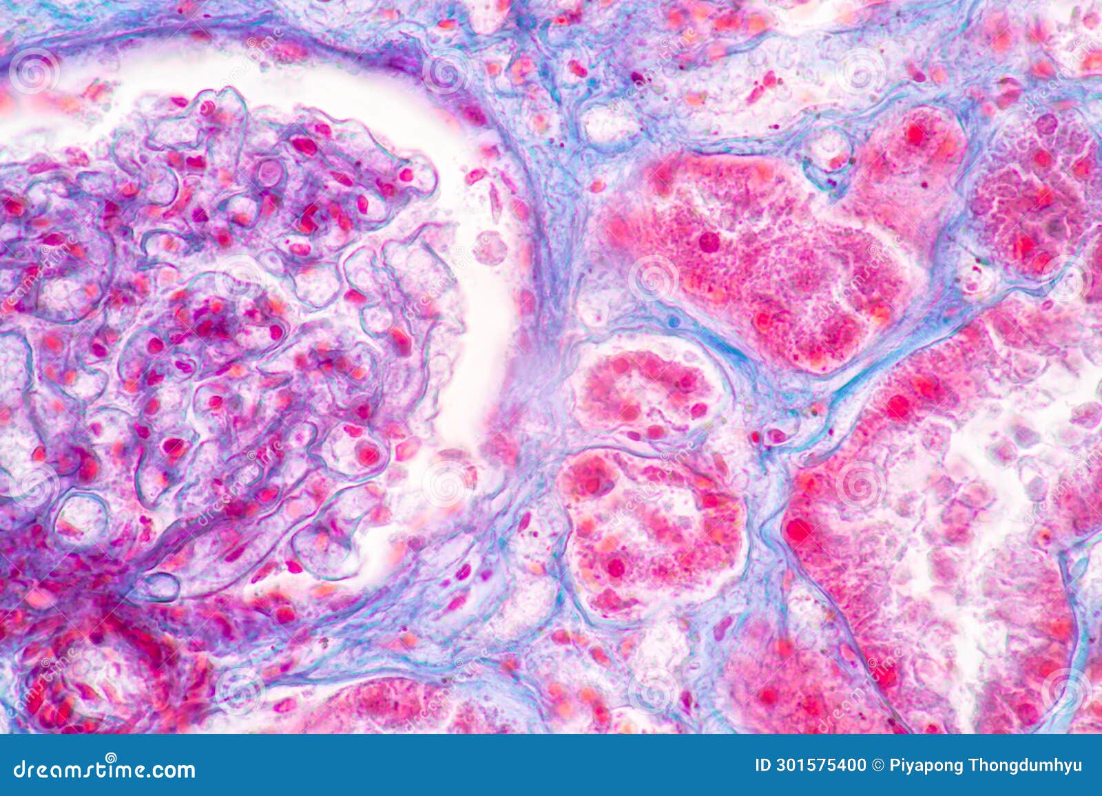 Tissue of Spleen Human, Liver Human and Kidney Human Under the ...