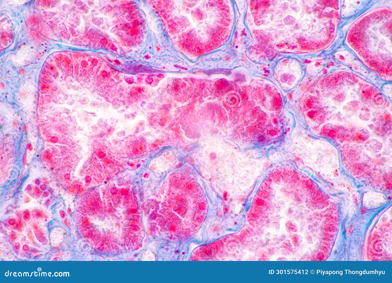 Tissue of Spleen Human, Liver Human and Kidney Human Under the ...