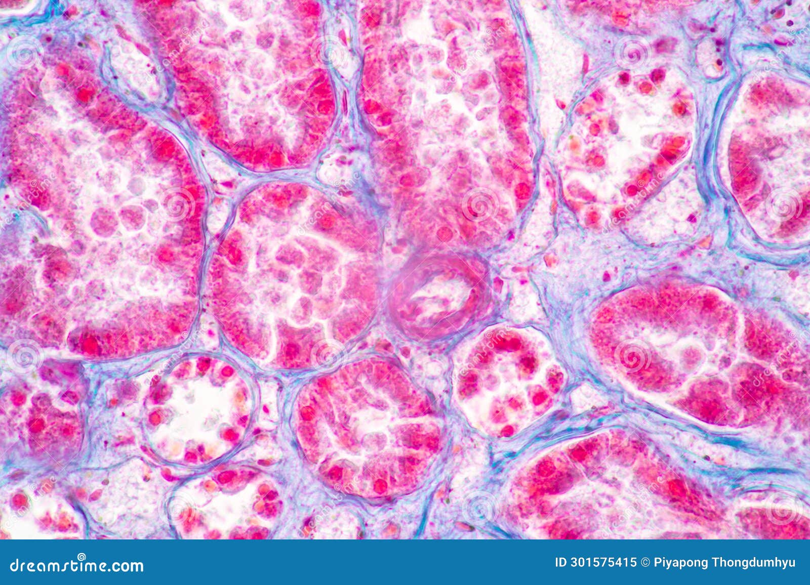 Tissue of Spleen Human, Liver Human and Kidney Human Under the ...