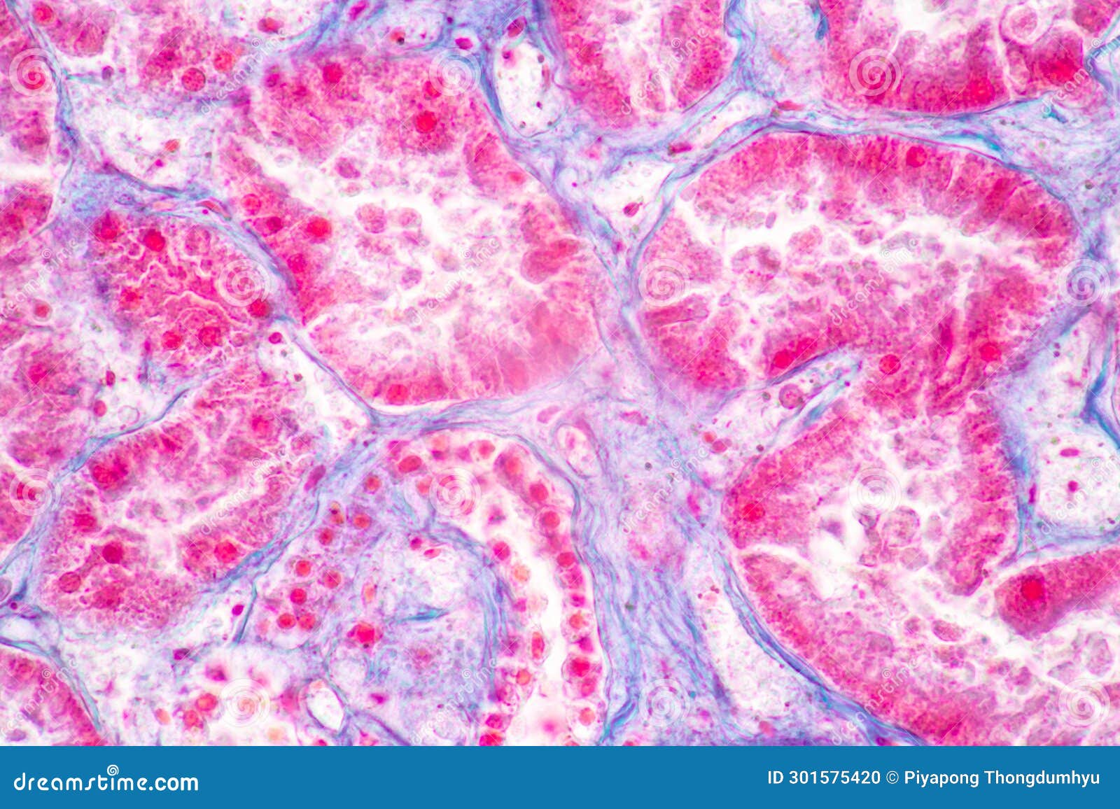 Tissue of Spleen Human, Liver Human and Kidney Human Under the ...