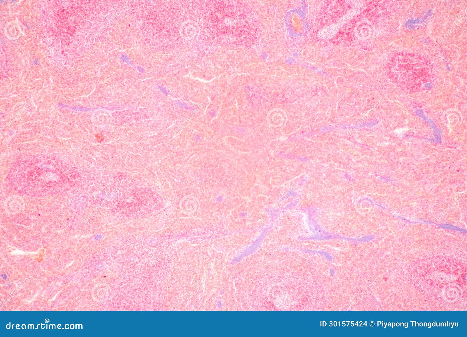 Tissue of Spleen Human, Liver Human and Kidney Human Under the ...