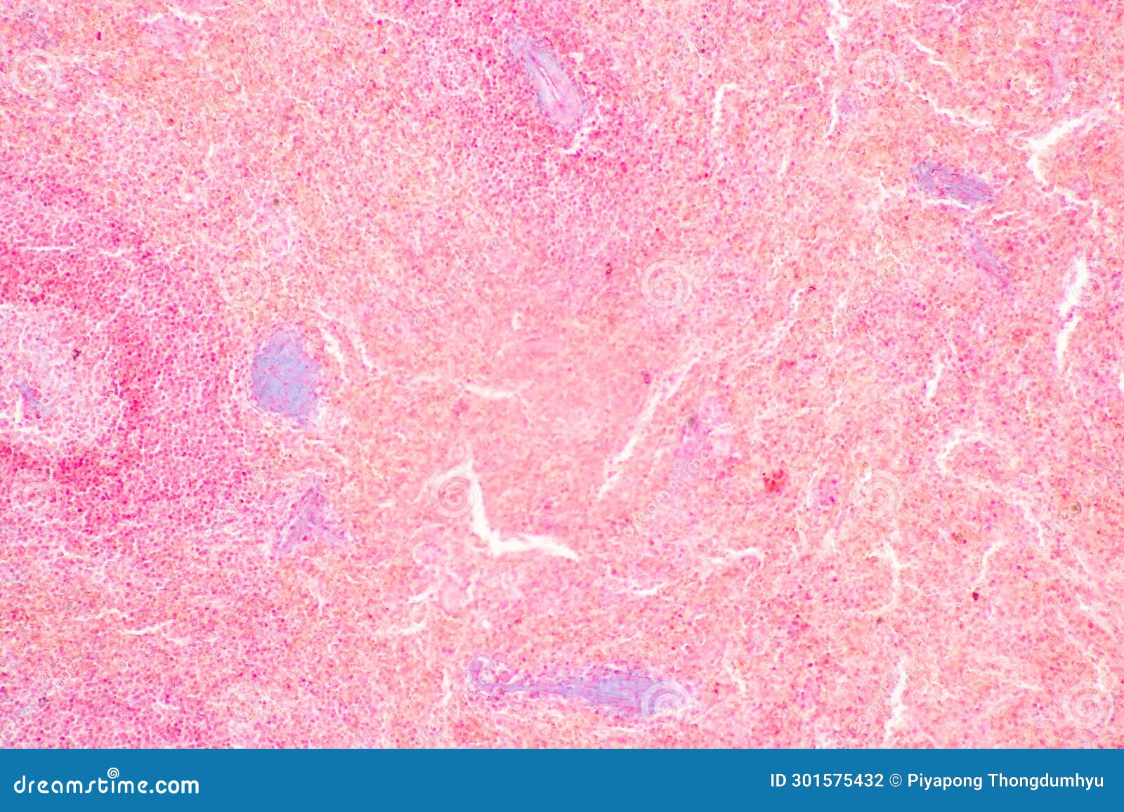 Tissue of Spleen Human, Liver Human and Kidney Human Under the ...