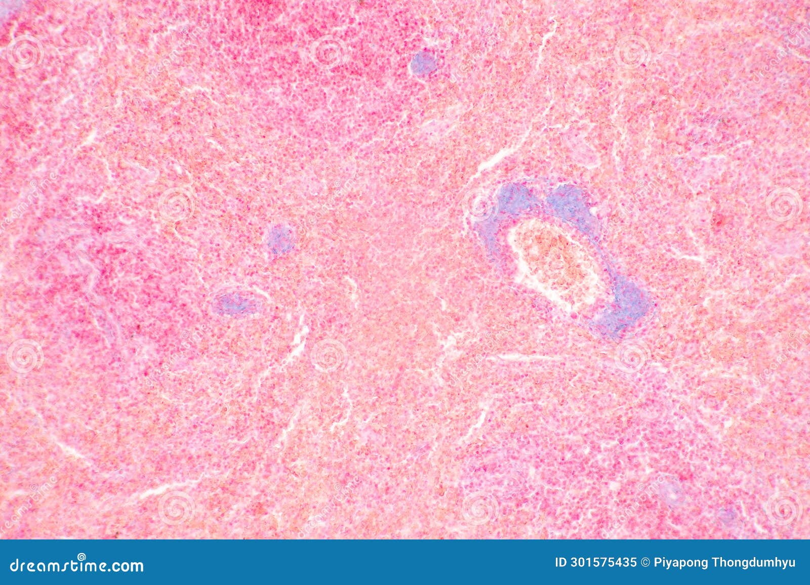 Tissue of Spleen Human, Liver Human and Kidney Human Under the ...