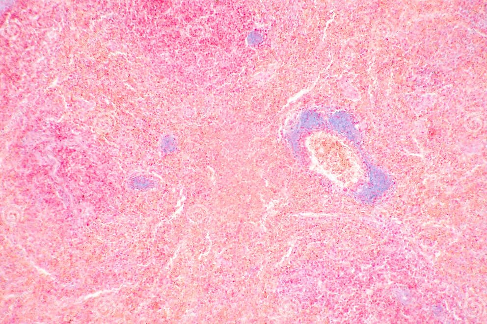 Tissue of Spleen Human, Liver Human and Kidney Human Under the ...