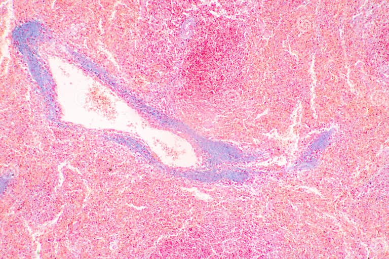 Tissue of Spleen Human, Liver Human and Kidney Human Under the ...