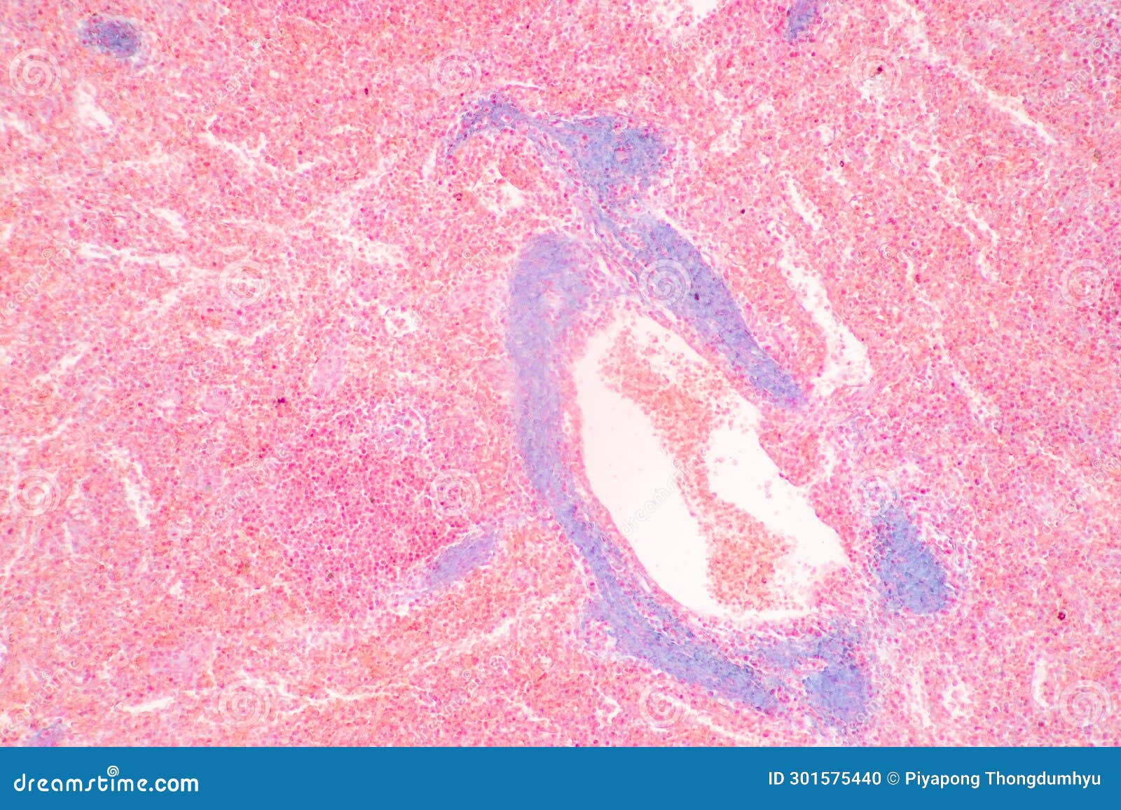 Tissue of Spleen Human, Liver Human and Kidney Human Under the ...