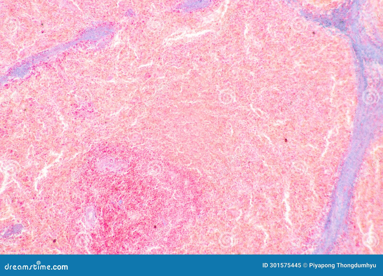Tissue Of Spleen Human, Liver Human And Kidney Human Under The ...