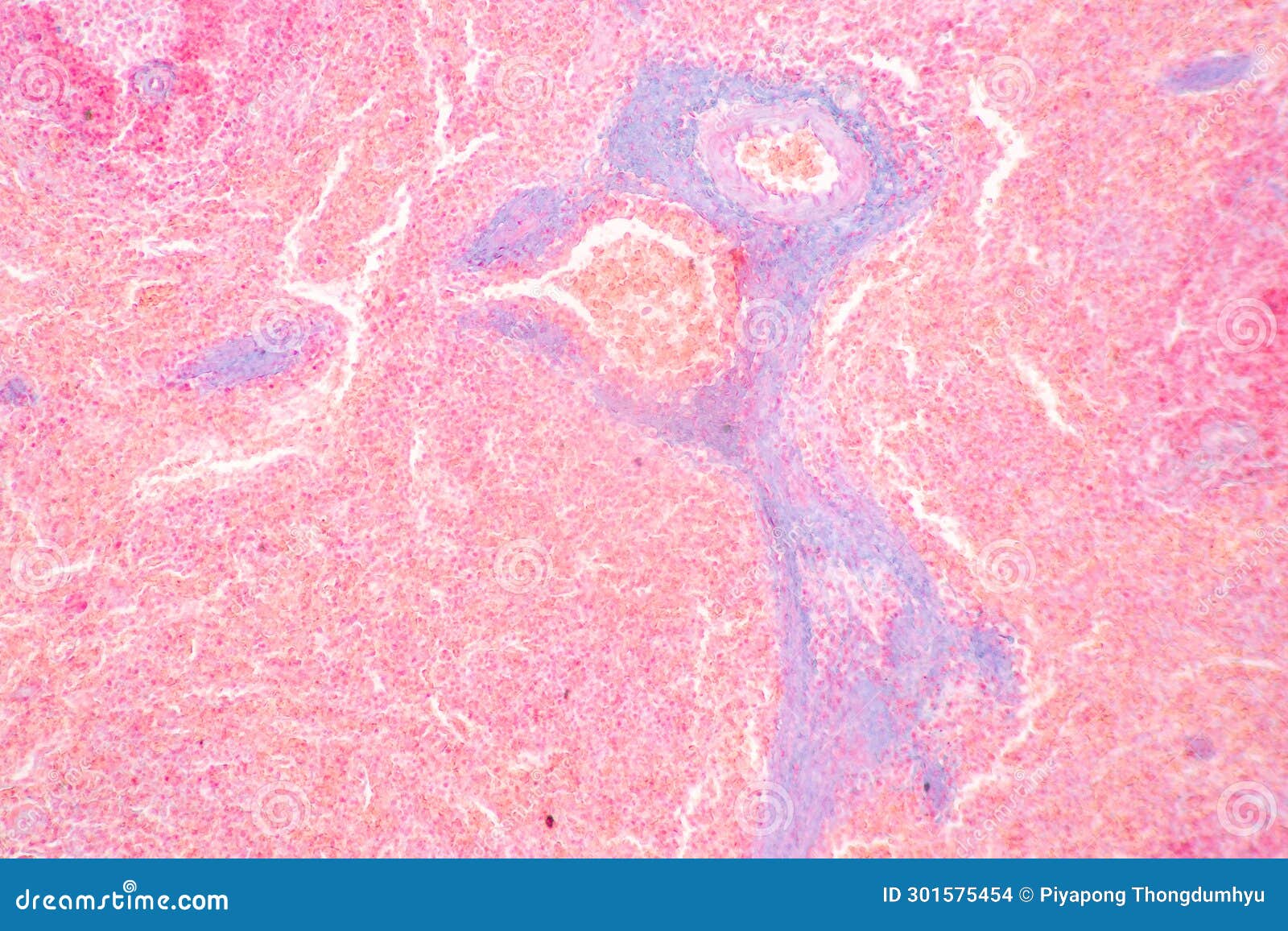 Tissue of Spleen Human, Liver Human and Kidney Human Under the ...
