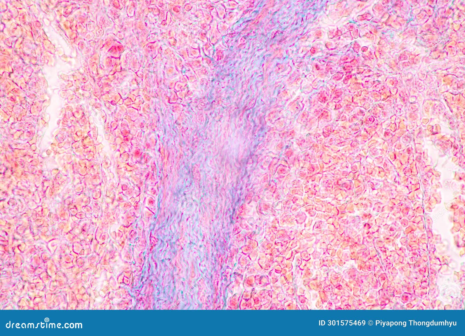 Tissue Of Spleen Human, Liver Human And Kidney Human Under The ...