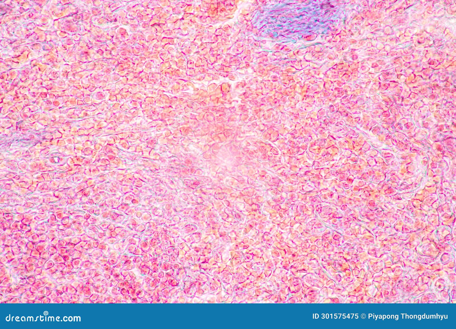 Tissue of Spleen Human, Liver Human and Kidney Human Under the ...
