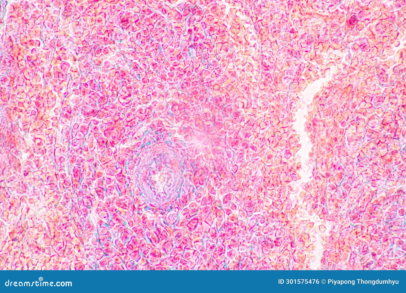 Tissue of Spleen Human, Liver Human and Kidney Human Under the ...