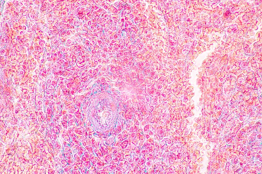 Tissue of Spleen Human, Liver Human and Kidney Human Under the ...
