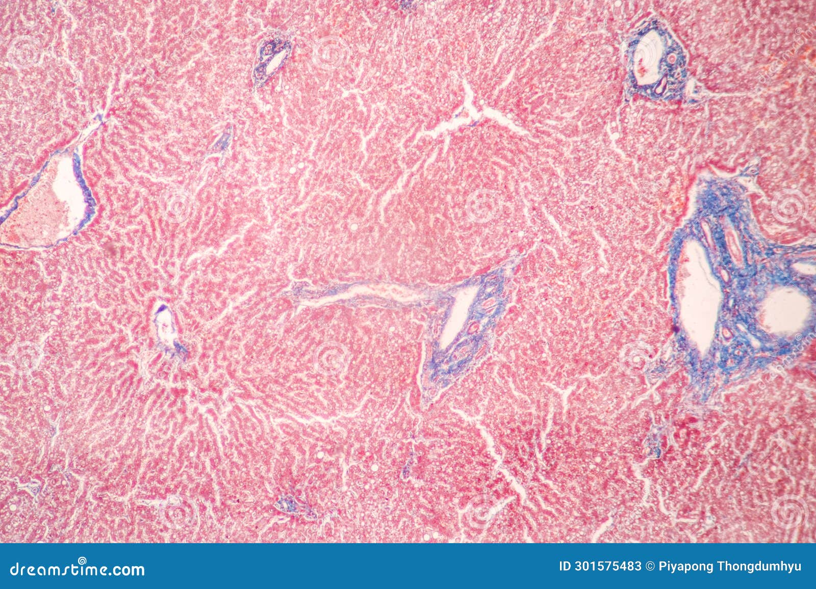 Tissue of Spleen Human, Liver Human and Kidney Human Under the ...