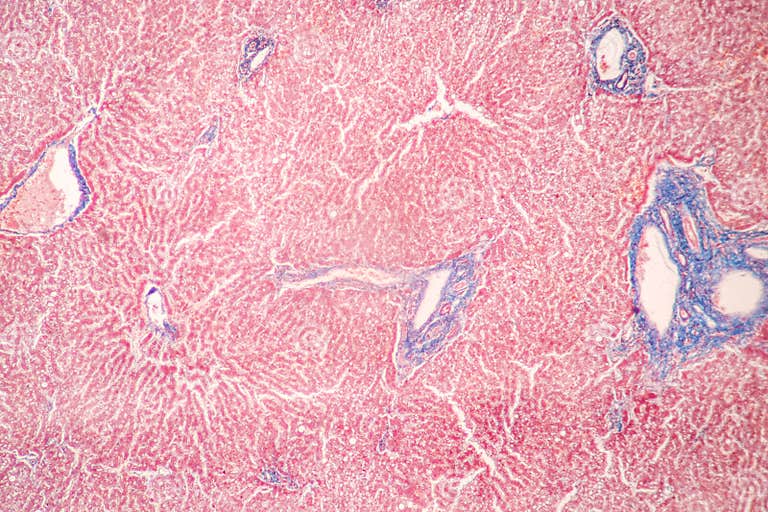 Tissue of Spleen Human, Liver Human and Kidney Human Under the ...