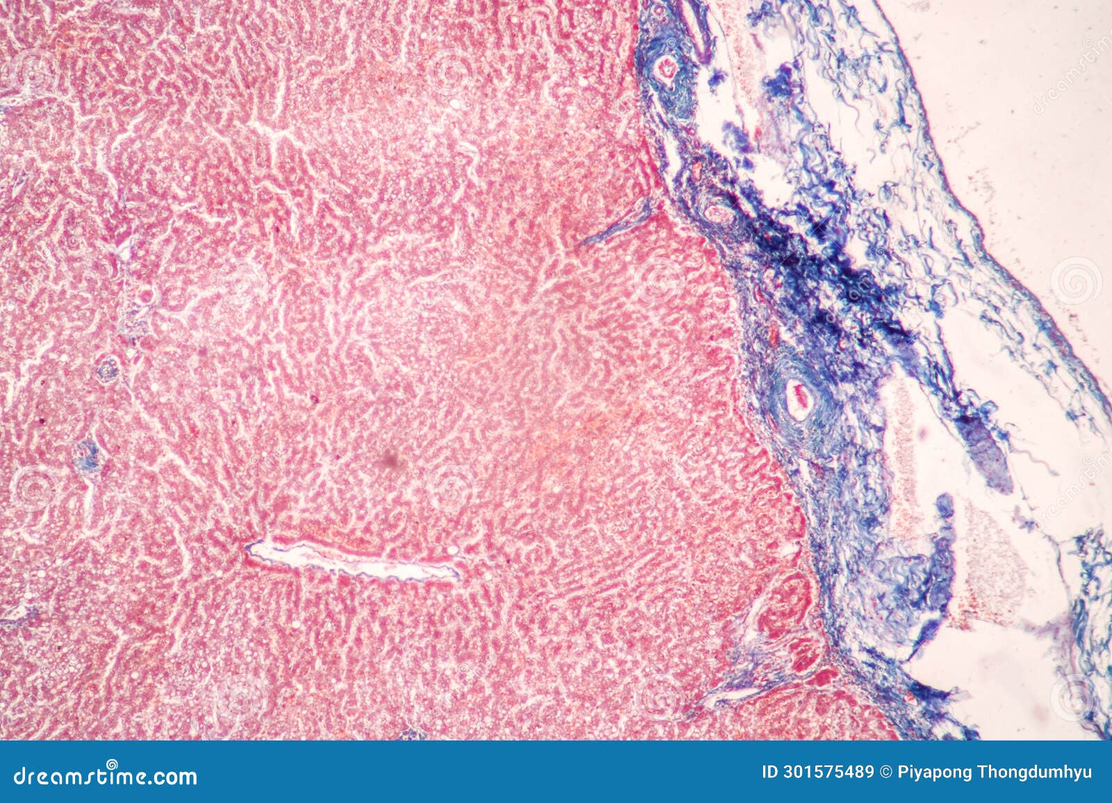Tissue of Spleen Human, Liver Human and Kidney Human Under the ...