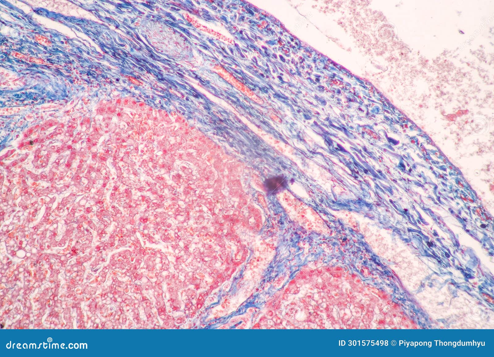 Tissue of Spleen Human, Liver Human and Kidney Human Under the ...