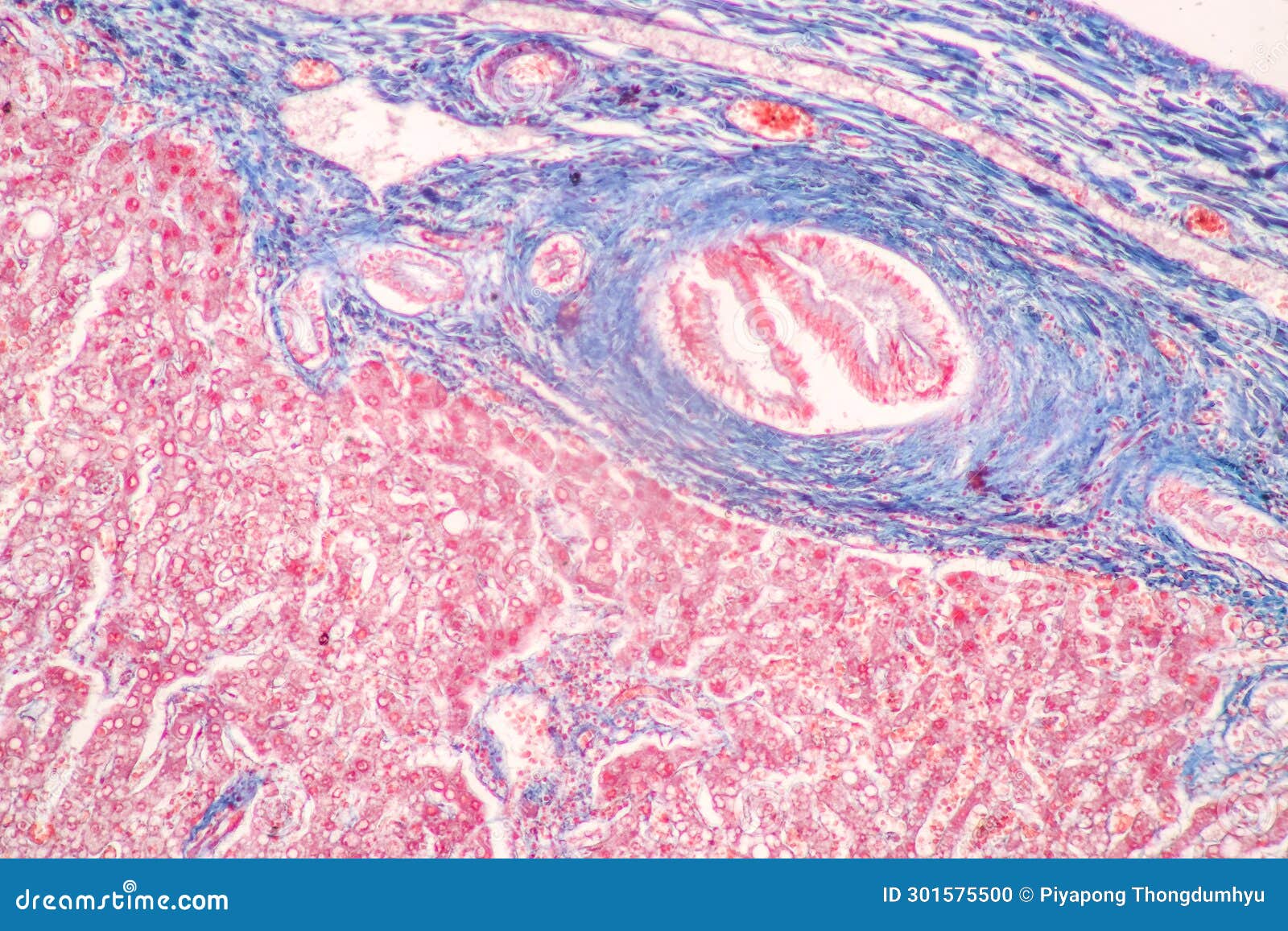 Tissue of Spleen Human, Liver Human and Kidney Human Under the ...