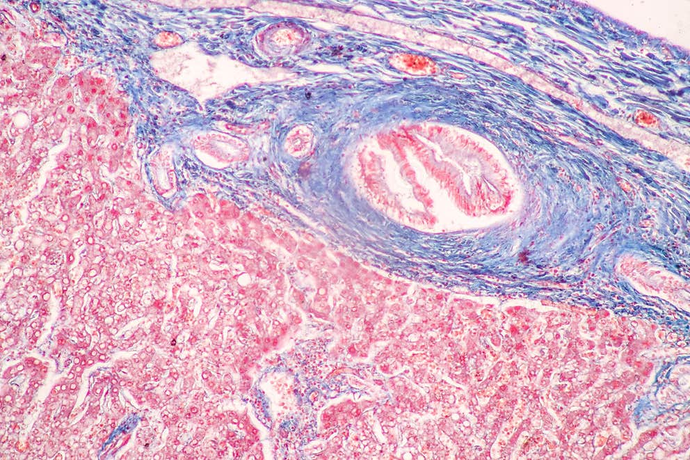 Tissue of Spleen Human, Liver Human and Kidney Human Under the ...