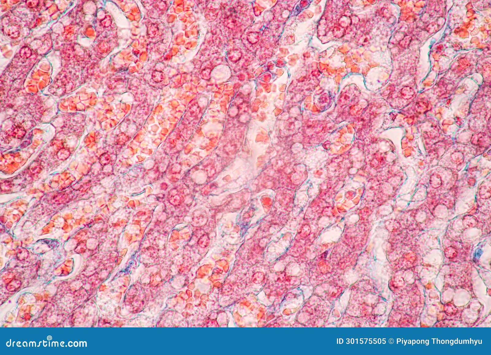 Tissue of Spleen Human, Liver Human and Kidney Human Under the ...