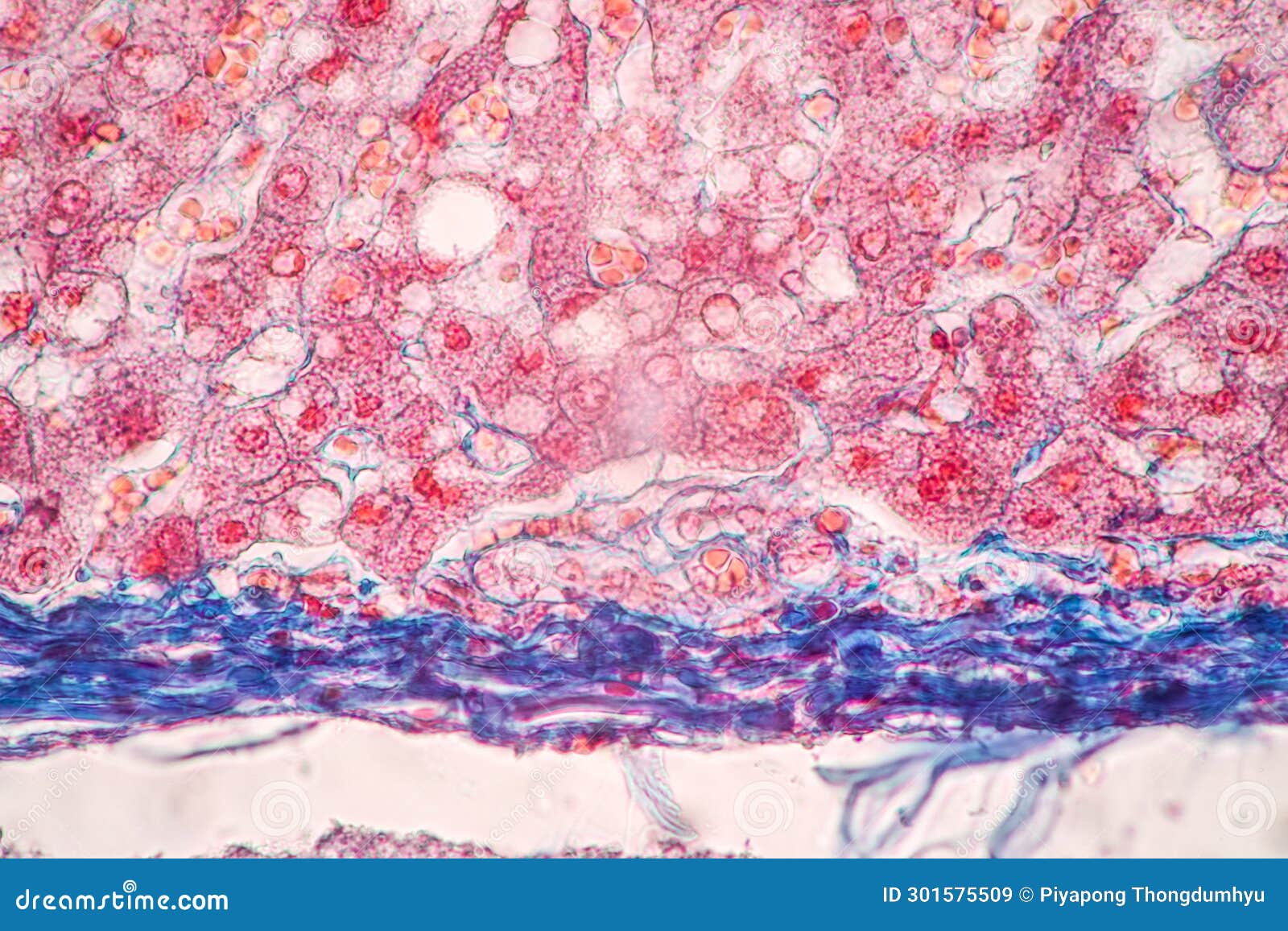 Tissue Of Spleen Human, Liver Human And Kidney Human Under The ...