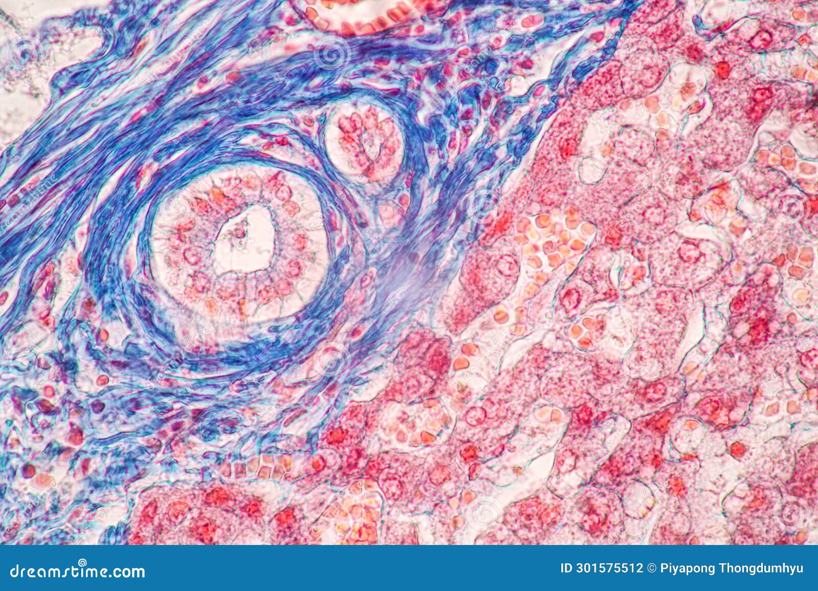Tissue of Spleen Human, Liver Human and Kidney Human Under the ...