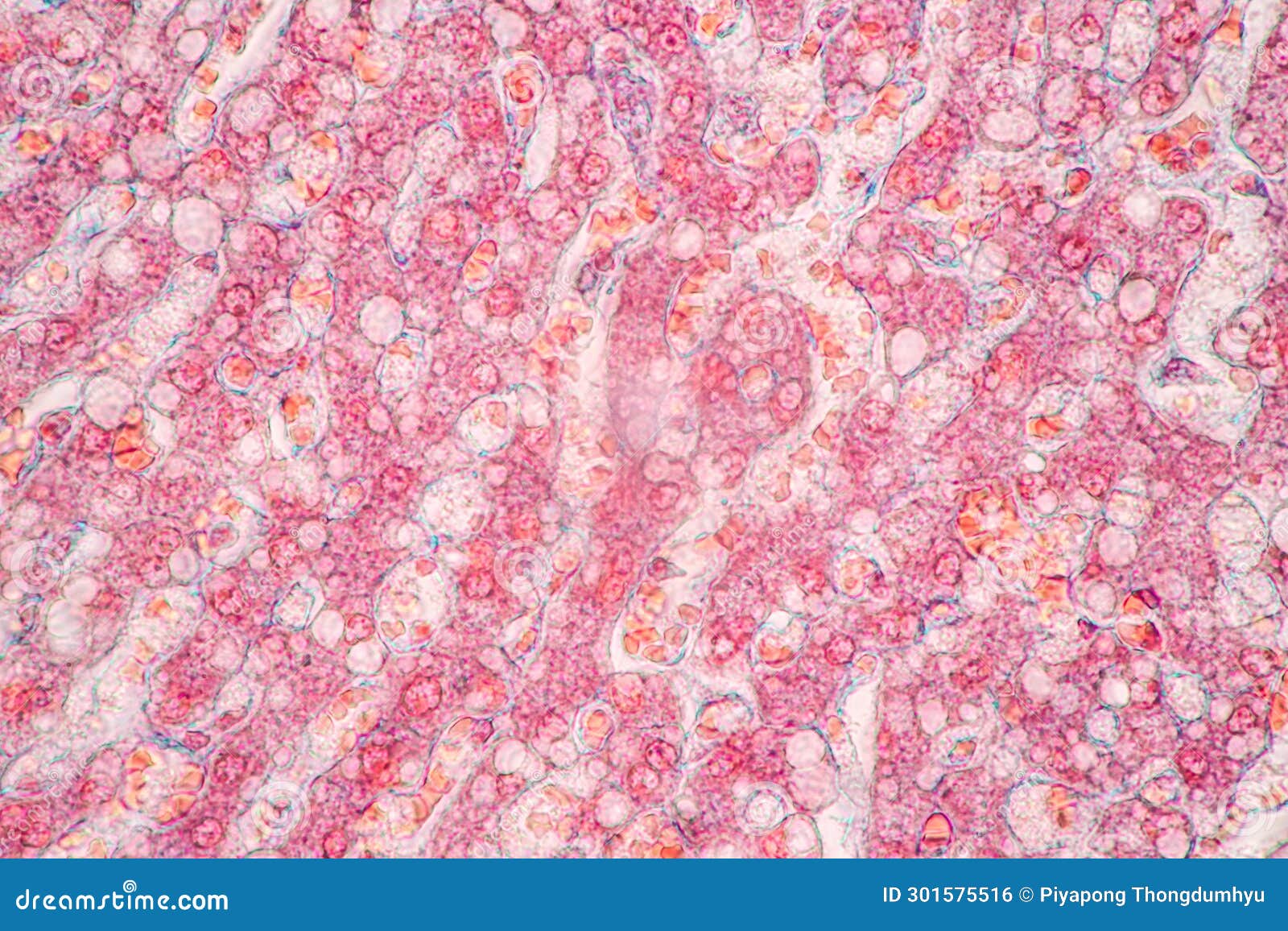 Tissue of Spleen Human, Liver Human and Kidney Human Under the ...