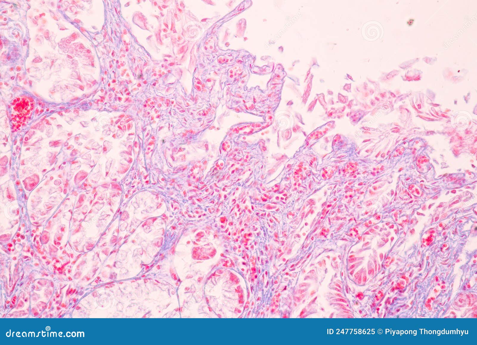 Tissue of Stomach Human Under the Microscope in Lab. Stock Image ...