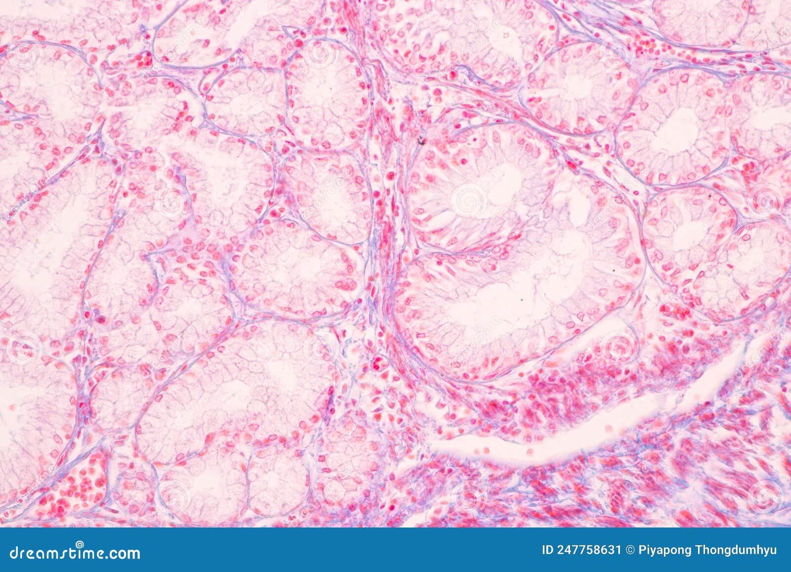 Tissue of Stomach Human Under the Microscope in Lab. Stock Image ...