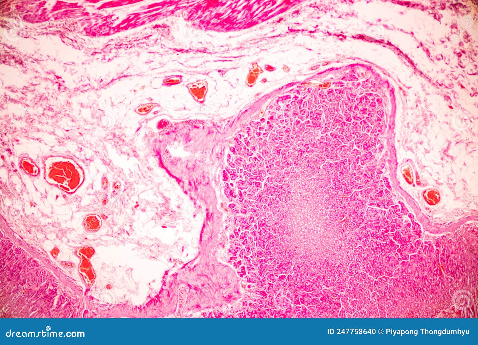 Tissue of Stomach Human Under the Microscope in Lab. Stock Photo ...