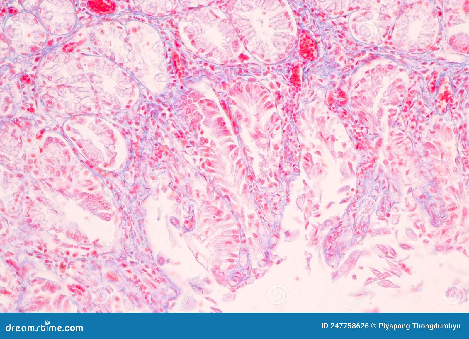 Tissue of Stomach Human Under the Microscope in Lab. Stock Photo ...